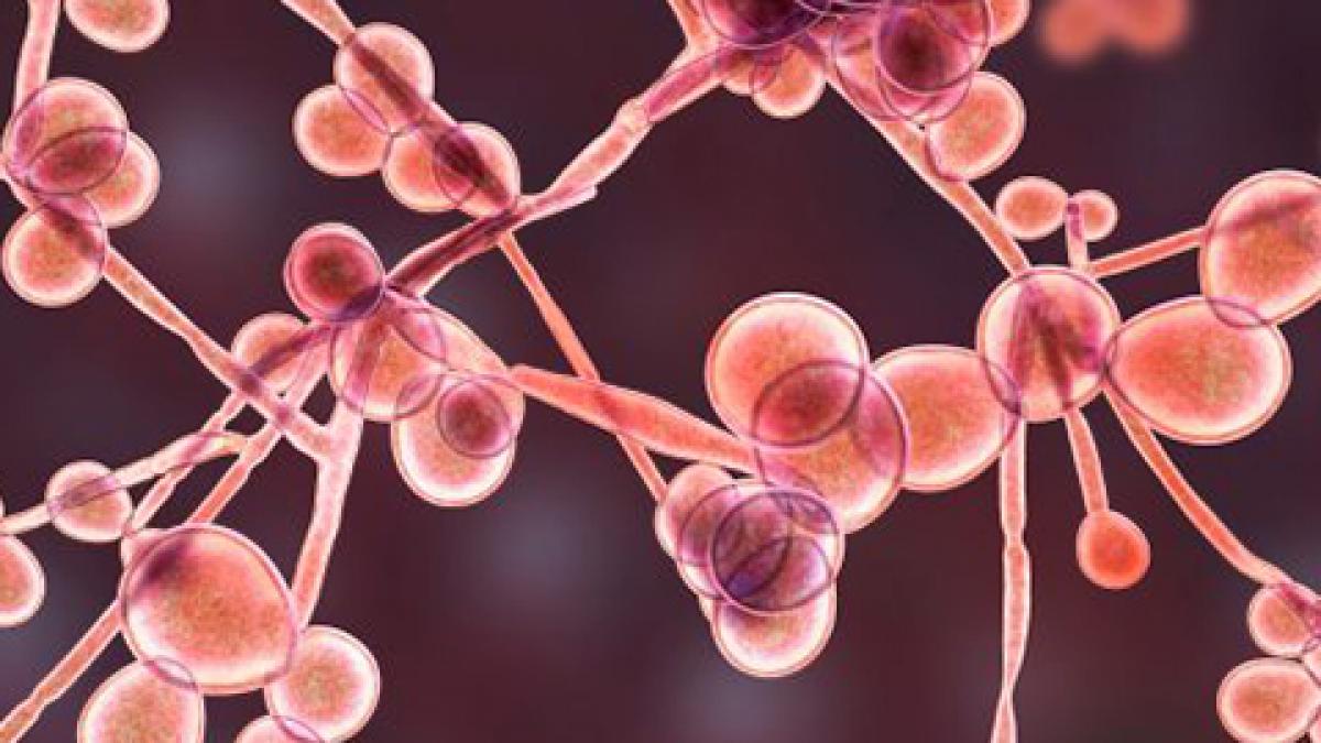 ESICM/ESCMID task force on practical management of invasive candidiasis ...