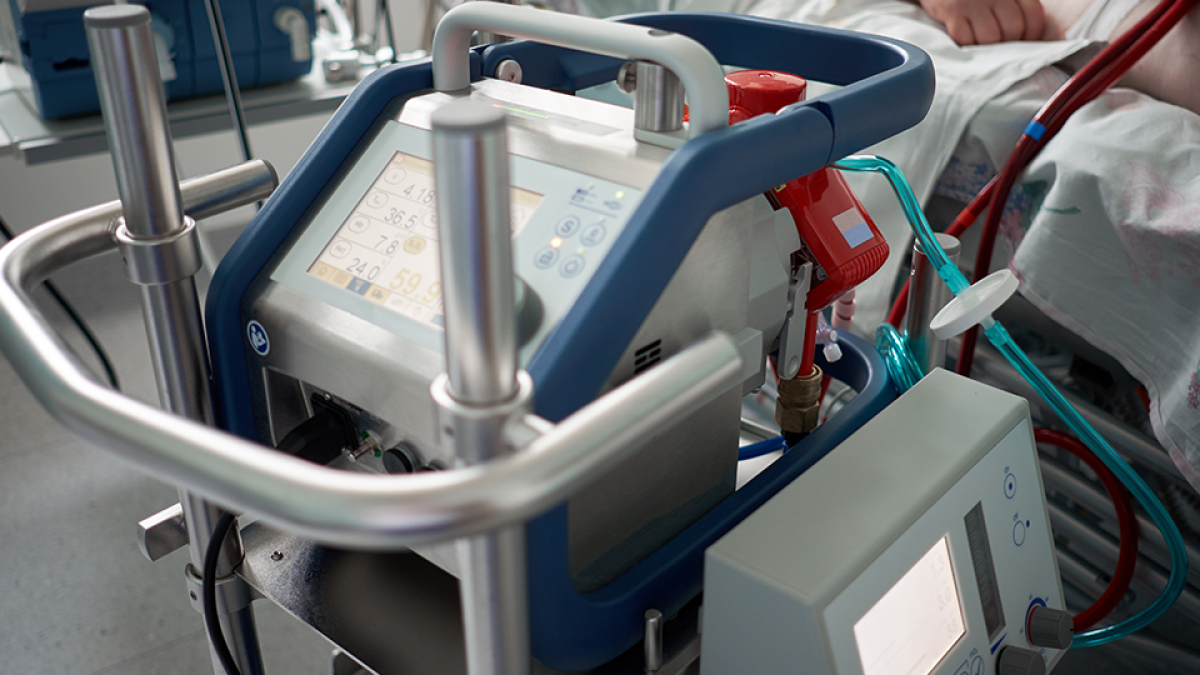 From inception to death : l’eCPR par ECMO VA en réanimation des arrêts ...