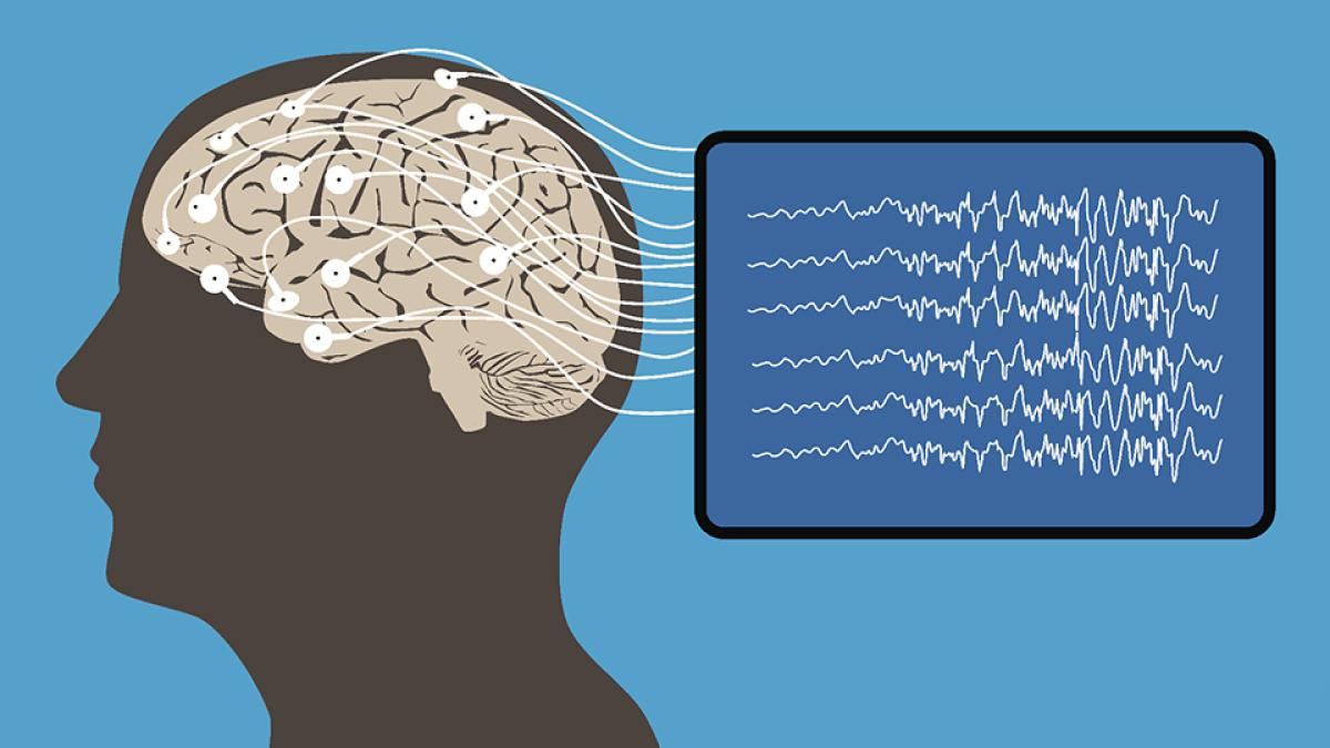 Activité EEG Périodiques et/ou Rythmiques ? Il y a plus d’un hic dans les comas post anoxiques ...