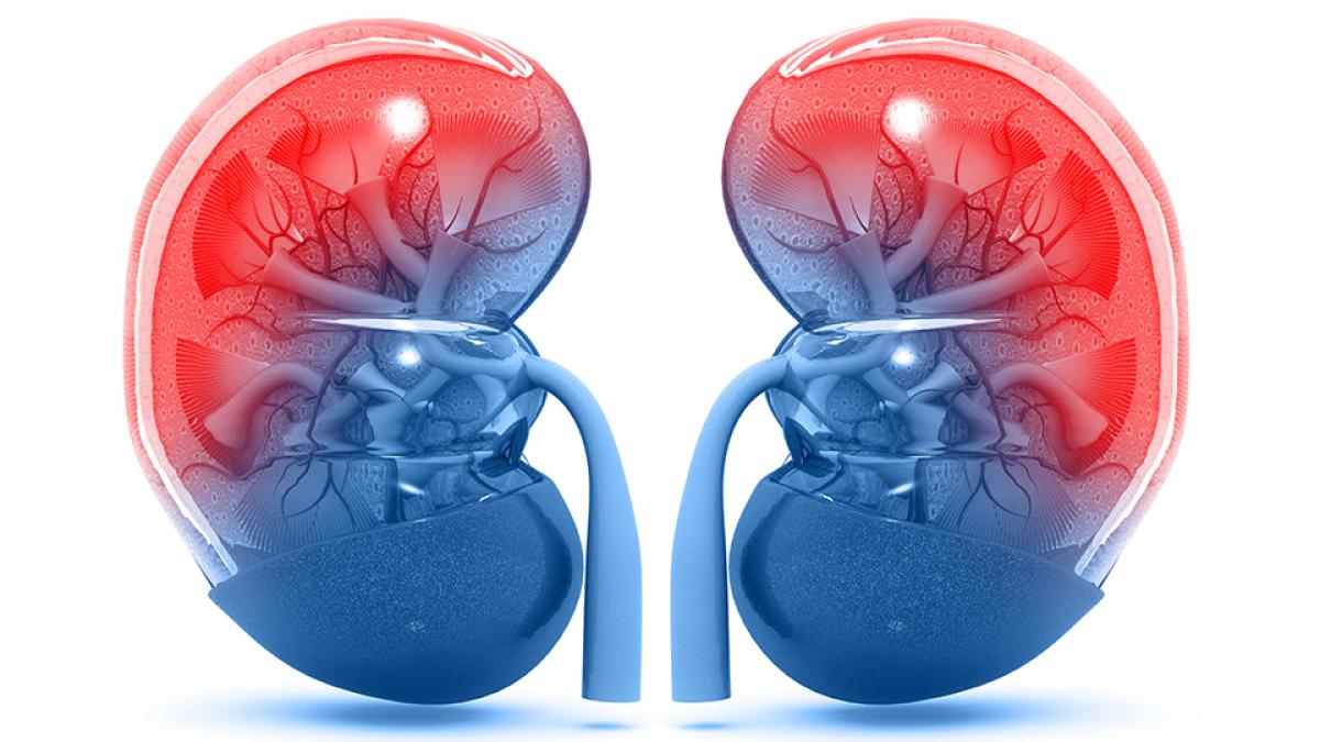Diagnostic et prise en charge de l’insuffisance rénale aiguë chez le ...