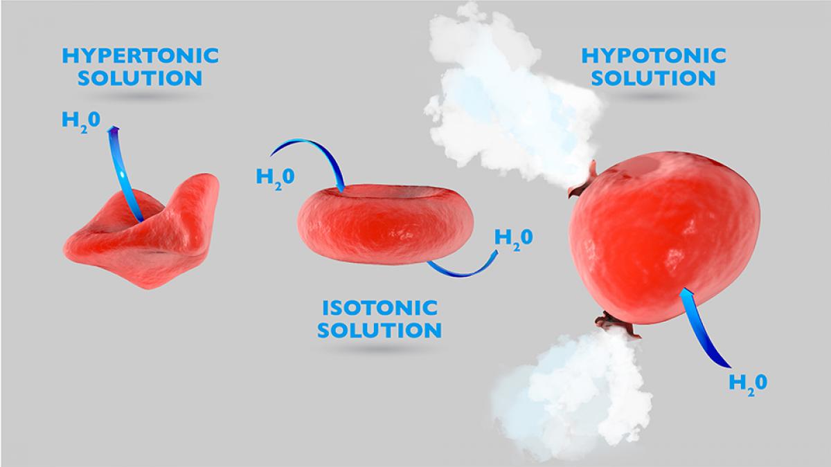 Impact des modifications de l’osmolalité plasmatique sur l’œdème ...