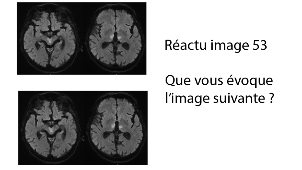 REACTU-Image 53 | SRLF
