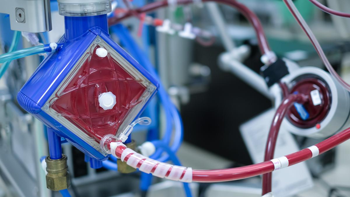 ECMO dans l’ACR intra-hospitalier : déplacer pour mieux canuler ? | SRLF